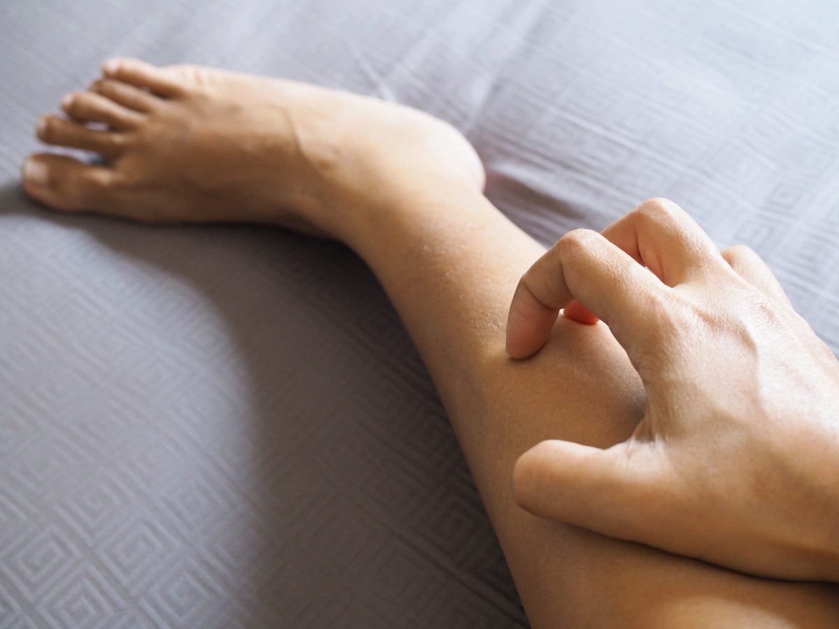 How to Easily Get Rid of Fleas - Drivin' & Vibin'